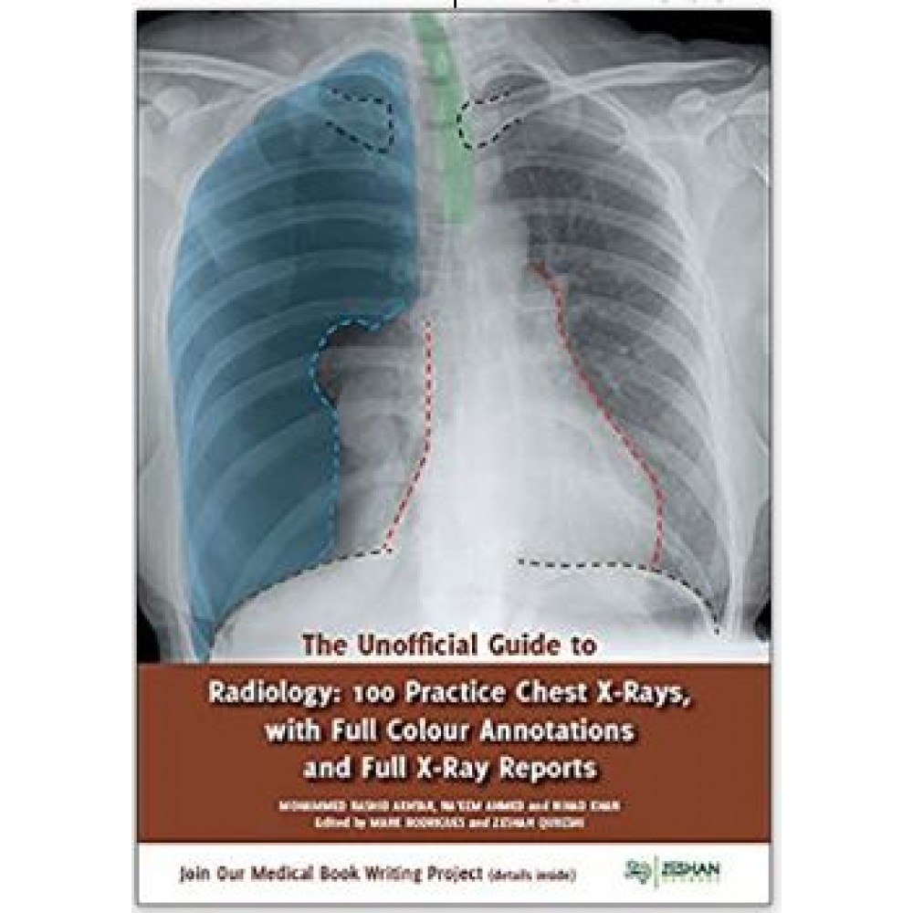 The,Unofficial,Guide to,Radiology,100,Practice,Chest X-Rays,(Unofficial ...