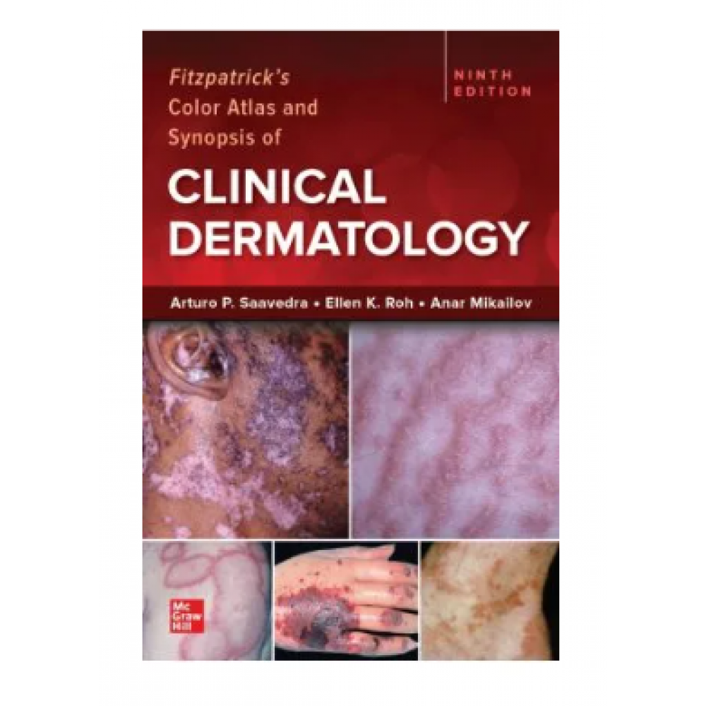 Fitzpatrick's Color Atlas and Synopsis of Clinical Dermatology;9th ...