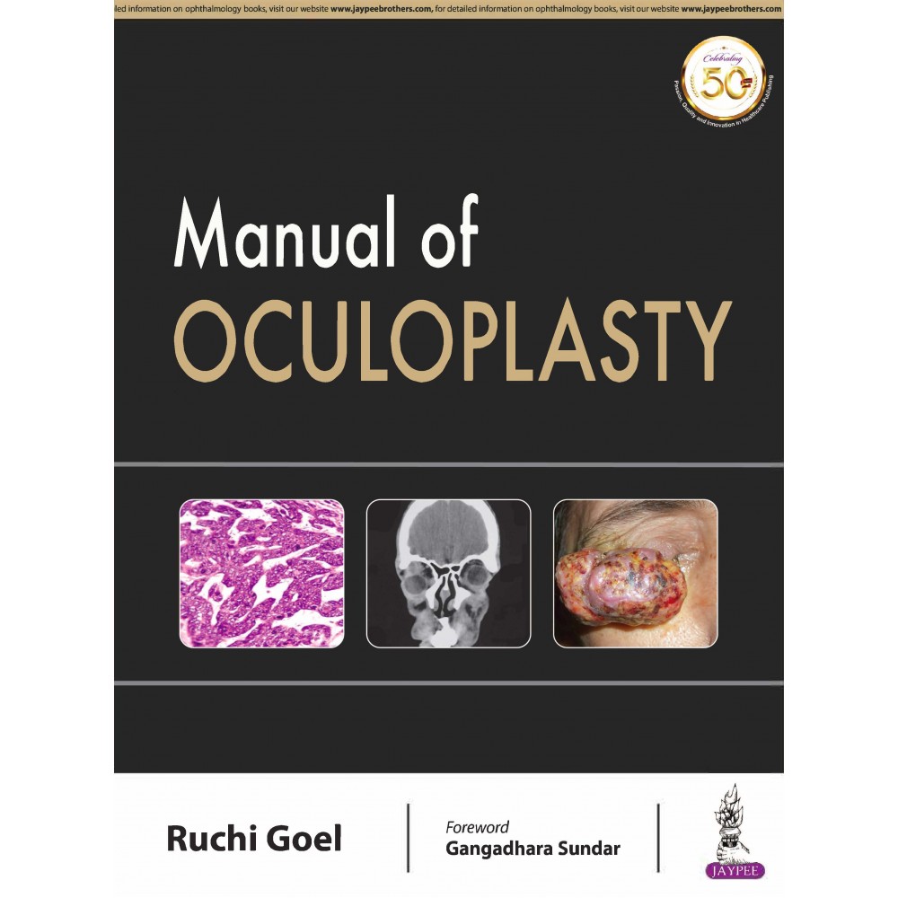 Manual Of Oculoplasty 1st Edition 2019 By Ruchi Goel